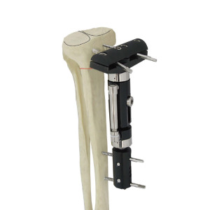 Proximal Tibia Fragment External Fixator | ASCO Medical