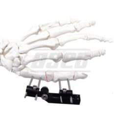 Mini Fragment External Fixator for Finger & Palm Articulated Minirail ...