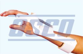 Dynamic Radial Palsy Splint | ASCO Medical